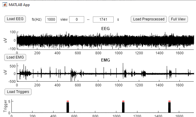 GitHub - li-shen-amy/eeg_sleep: MATLAB Code for Sleep cycle analysis ...